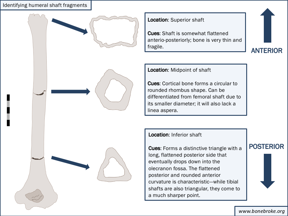 Feeling Shafted? Tips for identifying humeral shaft fragments | Bone Broke