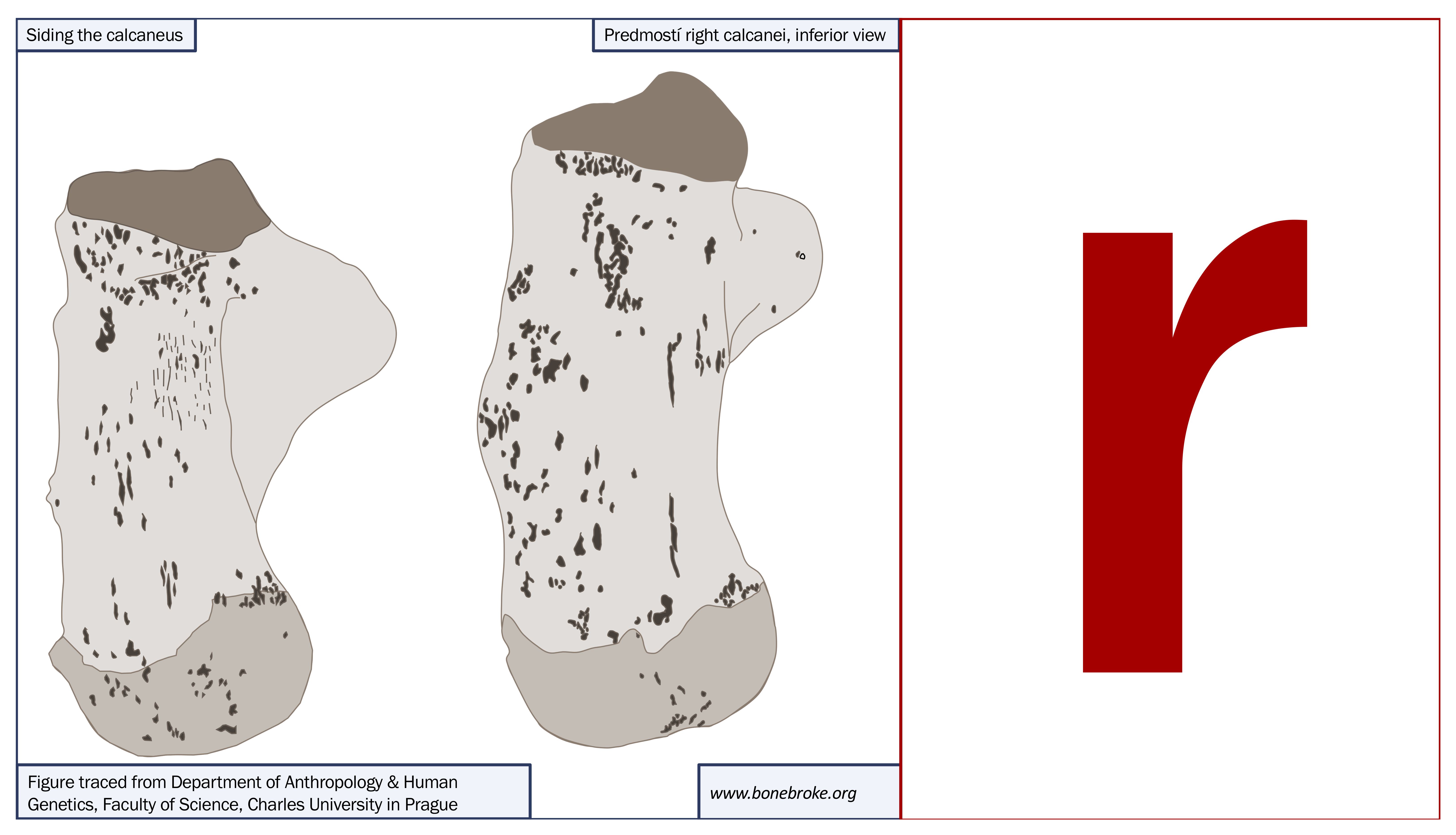 OsteoMenagerie 6: Tips for Siding the Calcaneus | Bone Broke