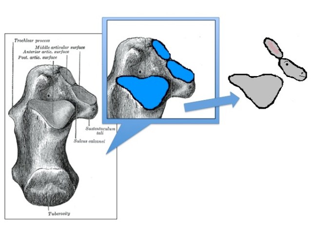 OsteoMenagerie 6: Tips for Siding the Calcaneus | Bone Broke