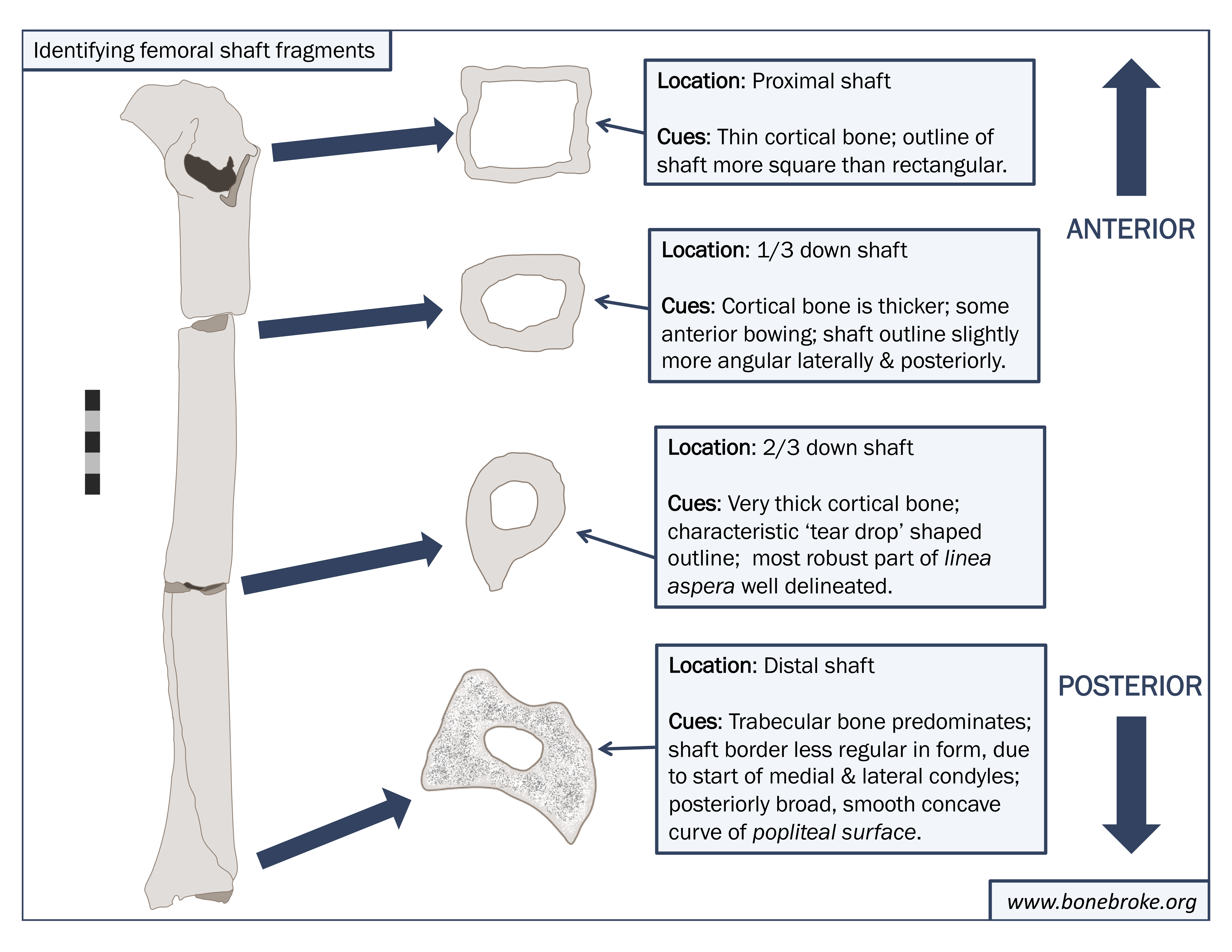 Get a leg up on the competition: Tips for identifying femoral shaft ...