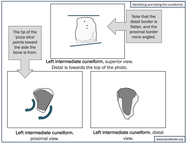 Merely a cuneiformality: Identifying and siding the cuneiforms | Bone Broke