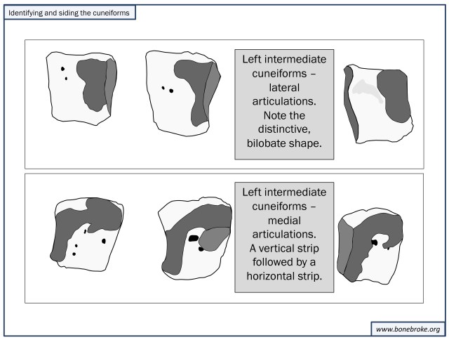 Merely a cuneiformality: Identifying and siding the cuneiforms | Bone Broke