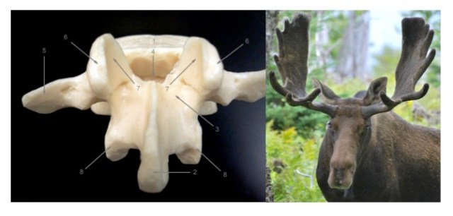 OsteoMenagerie 7: The Vertebrae | Bone Broke