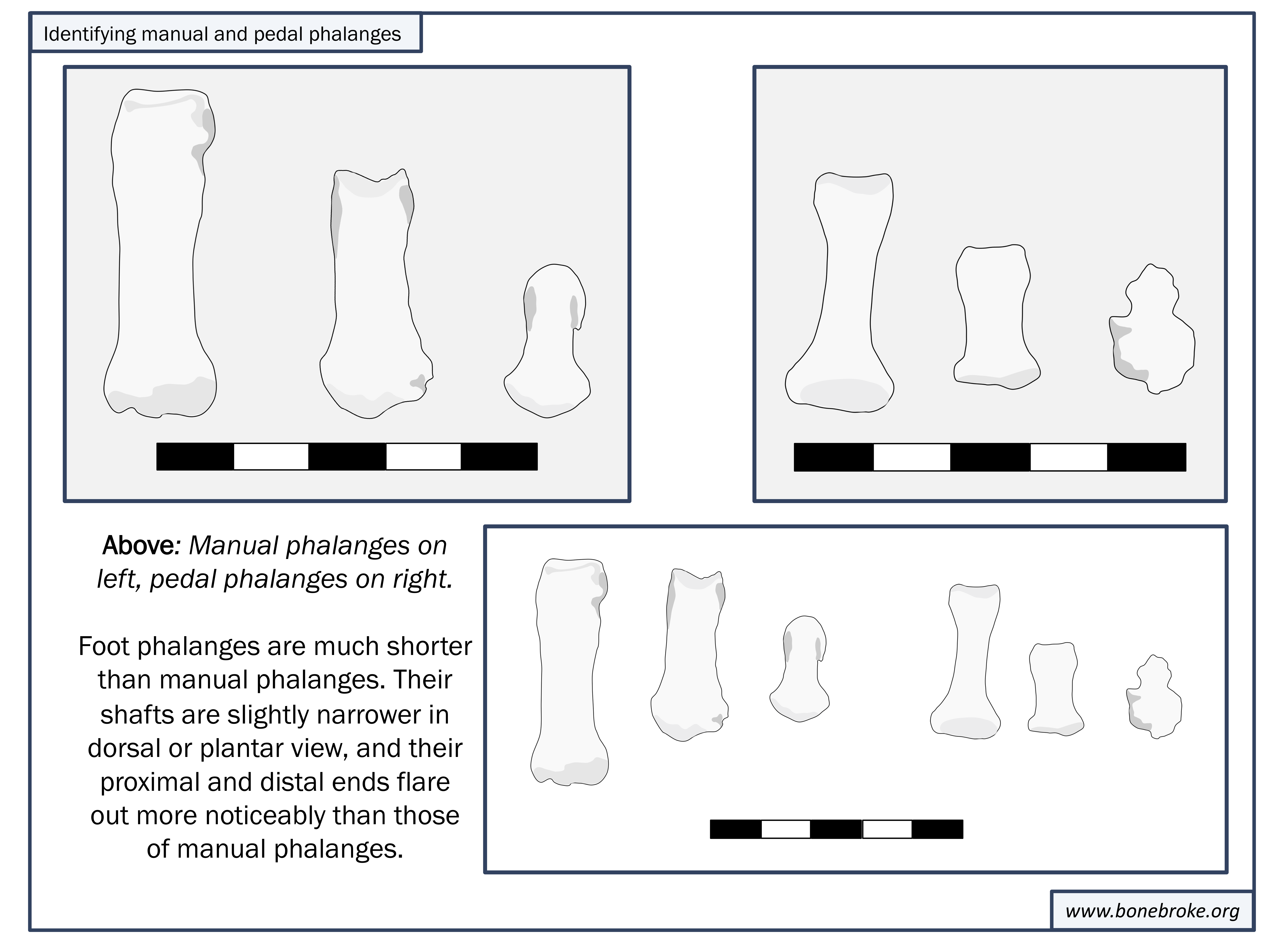 Gotta hand it to you: identifying manual and pedal phalanges | Bone Broke