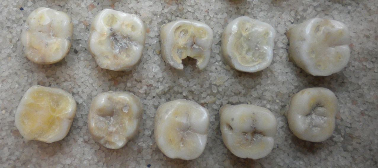 Identifying Human Teeth: Human Dentition Cheat Sheet | Bone Broke