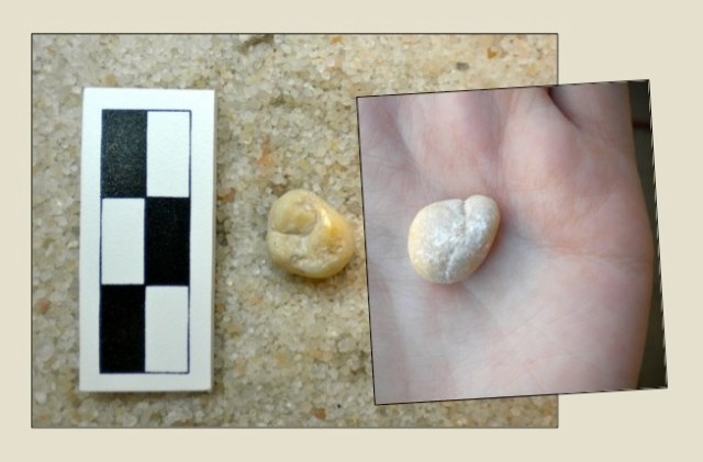 Osteology Everywhere: Pebble Edition | Bone Broke