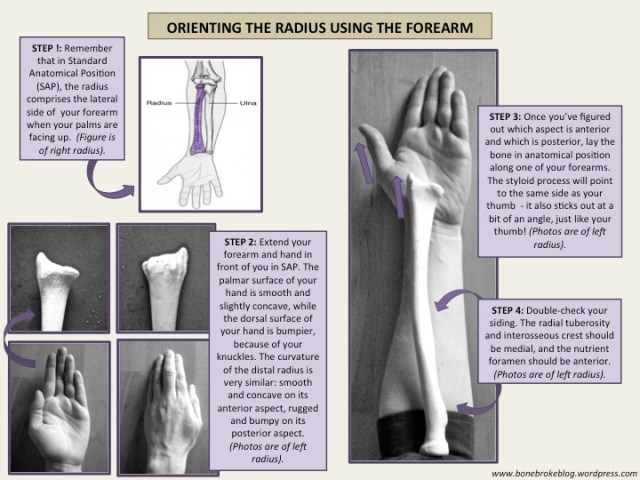 That’s so rad: Identifying and siding the radius | Bone Broke