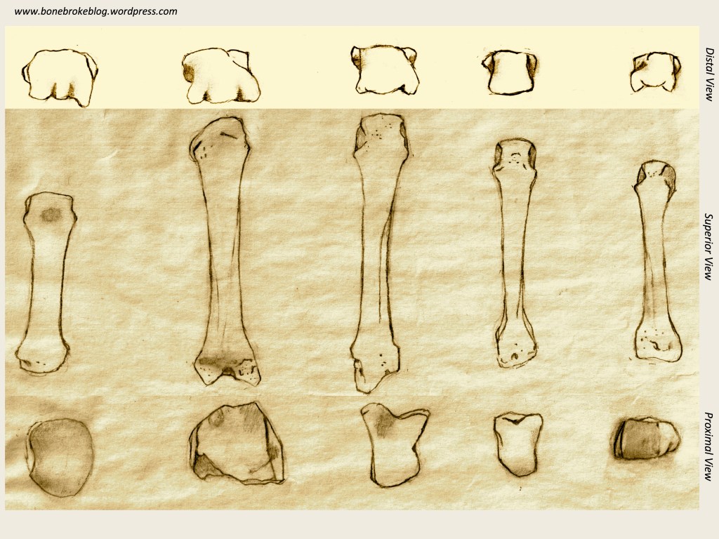 Identifying the Metacarpals in Three Easy Steps | Bone Broke